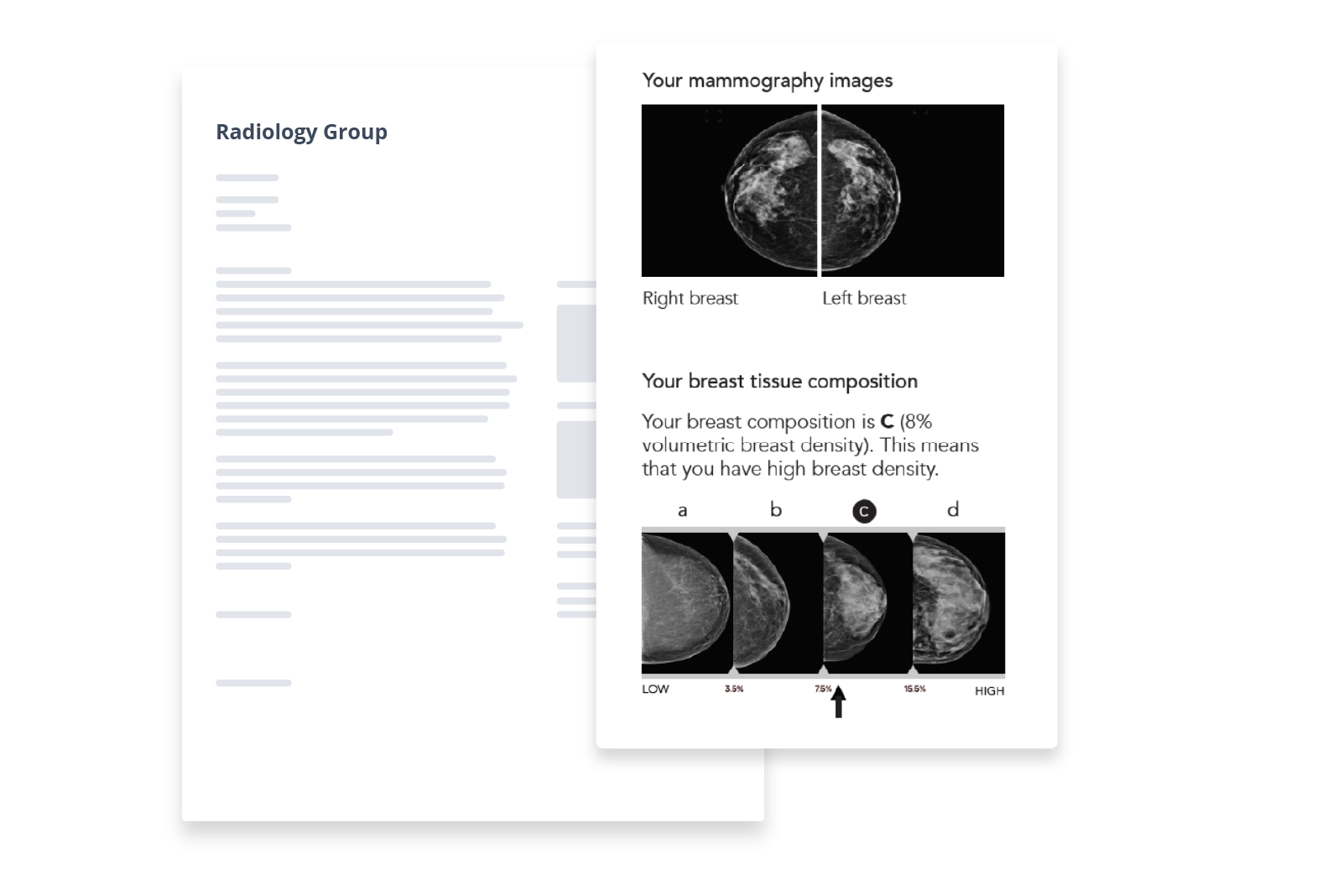 There’s more to know about breast density – Volpara Health
